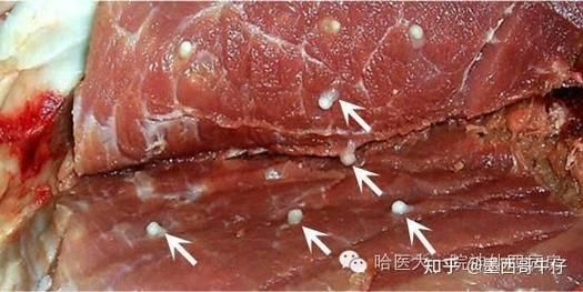 绦虫节片长什么样_绦虫节片会传染人吗-第3张图片-山城妙识