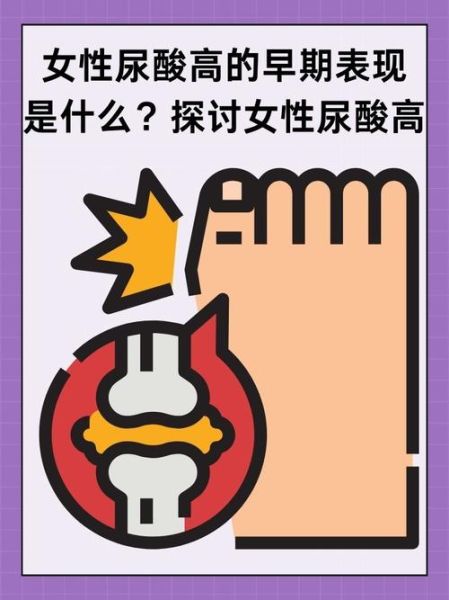 女性尿酸高的早期表现_尿酸高初期症状有哪些-第2张图片-山城妙识 女性尿酸高的早期表现_尿酸高初期症状有哪些-第2张图片-山城妙识