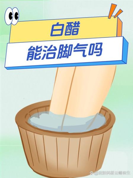 脚气用醋泡脚的正确方法_多久见效-第1张图片-山城妙识