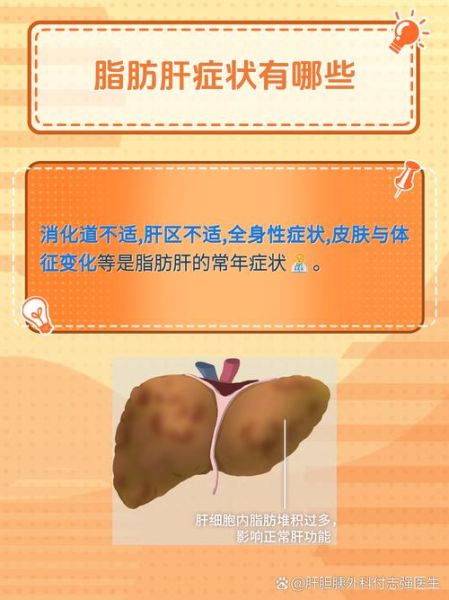 脂肪肝的症状有哪些_脂肪肝早期表现-第3张图片-山城妙识