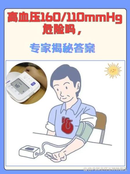 高血压160110危险吗_需要立即就医吗-第1张图片-山城妙识 高血压160110危险吗_需要立即就医吗-第1张图片-山城妙识