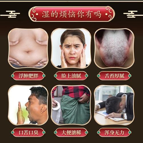 参苓白术散能去湿气吗_服用多久见效-第1张图片-山城妙识
