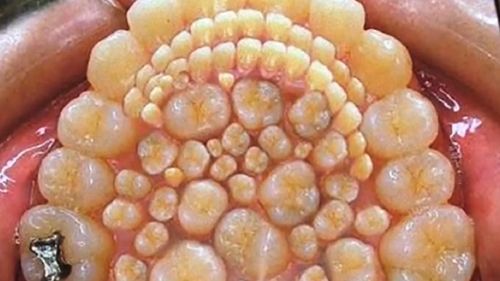 莲蓬乳皮肤病图片_怎么辨别真假-第1张图片-山城妙识 莲蓬乳皮肤病图片_怎么辨别真假-第1张图片-山城妙识