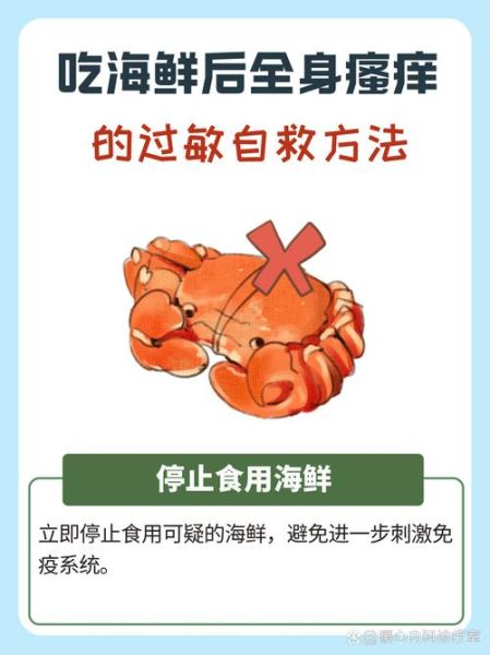 海鲜菇什么人不能吃_海鲜菇过敏症状有哪些-第2张图片-山城妙识 海鲜菇什么人不能吃_海鲜菇过敏症状有哪些-第2张图片-山城妙识