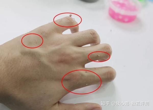 辣椒素在手上残留多久_怎么快速洗掉-第3张图片-山城妙识