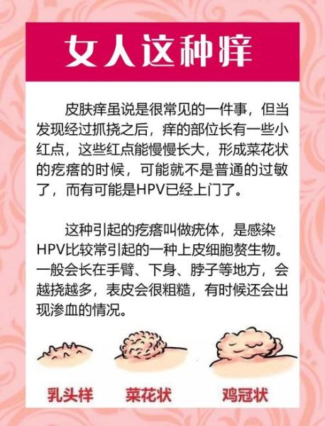 菜花病是怎么引起的_菜花病是什么引起的-第2张图片-山城妙识 菜花病是怎么引起的_菜花病是什么引起的-第2张图片-山城妙识