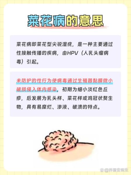 菜花病是怎么引起的_菜花病是什么引起的-第3张图片-山城妙识 菜花病是怎么引起的_菜花病是什么引起的-第3张图片-山城妙识