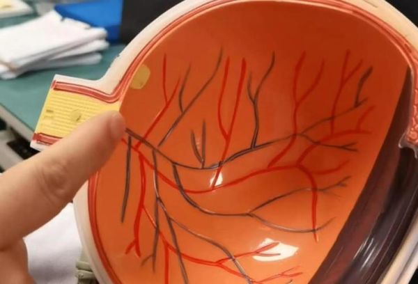 脉络膜是什么_脉络膜炎怎么治疗-第2张图片-山城妙识 脉络膜是什么_脉络膜炎怎么治疗-第2张图片-山城妙识