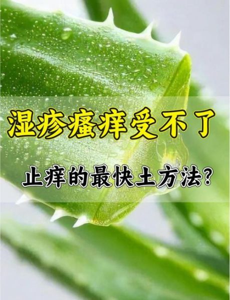 湿疹最怕的三个土办法_真的有用吗-第3张图片-山城妙识 湿疹最怕的三个土办法_真的有用吗-第3张图片-山城妙识