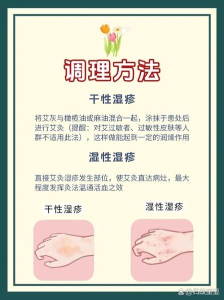 湿疹最怕的三个土办法_真的有用吗-第2张图片-山城妙识 湿疹最怕的三个土办法_真的有用吗-第2张图片-山城妙识