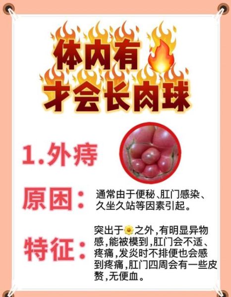 痔疮可以自愈吗_痔疮不治疗会好吗-第1张图片-山城妙识