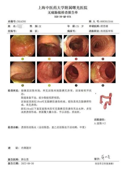 肠胃炎不去看会自愈吗_肠胃炎多久能好-第1张图片-山城妙识