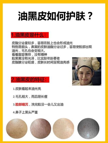 橄榄油护肤皮肤会变黑吗_怎么用才安全-第1张图片-山城妙识 橄榄油护肤皮肤会变黑吗_怎么用才安全-第1张图片-山城妙识