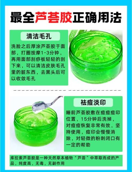 芦荟胶可以去痘痘和痘印吗_芦荟胶祛痘效果怎么样-第1张图片-山城妙识