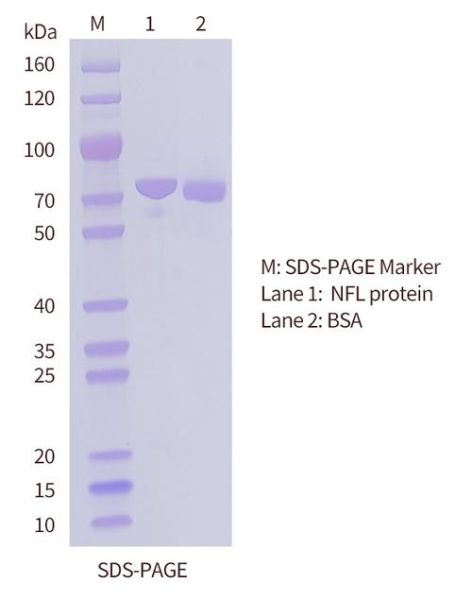 what_is_agarose_used_for_in_gel_electrophoresis-第3张图片-山城妙识