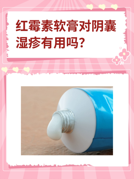 红霉素软膏有激素吗_孕妇能用吗-第1张图片-山城妙识