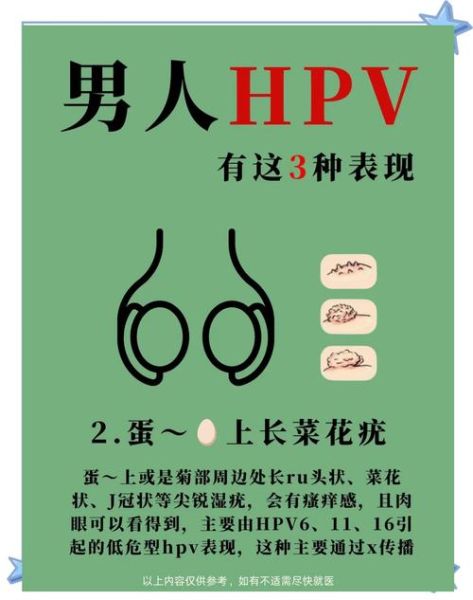 男性椰菜花病早期症状_怎么治疗彻底-第3张图片-山城妙识