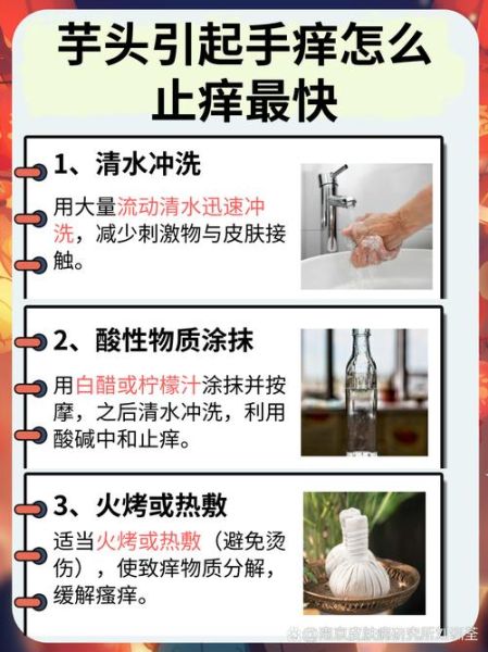 芋头手痒怎么快速止痒_芋头手痒用什么药-第1张图片-山城妙识 芋头手痒怎么快速止痒_芋头手痒用什么药-第1张图片-山城妙识