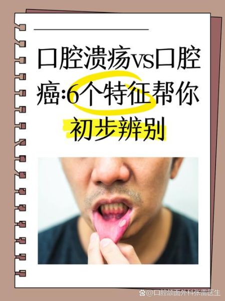 经常上火就是癌症信号_真的假的-第2张图片-山城妙识