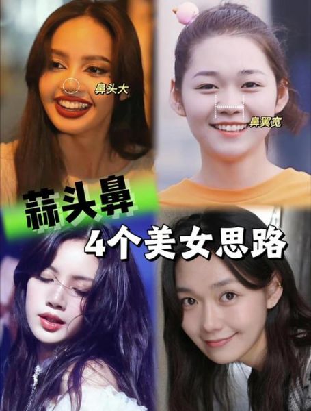 蒜头鼻长什么样_蒜头鼻怎么改善-第1张图片-山城妙识 蒜头鼻长什么样_蒜头鼻怎么改善-第1张图片-山城妙识