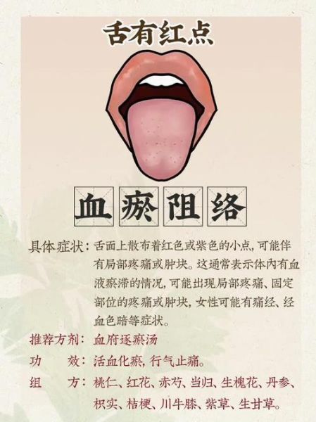 中医体质辨识方法_如何调理亚健康-第2张图片-山城妙识 中医体质辨识方法_如何调理亚健康-第2张图片-山城妙识