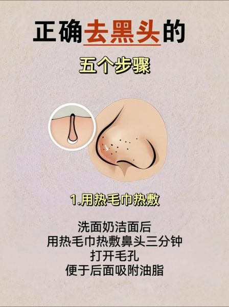 草莓鼻子怎么去掉_还能缩小毛孔吗-第1张图片-山城妙识