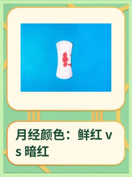 鲜红是什么原因_鲜红和暗红区别-第1张图片-山城妙识 鲜红是什么原因_鲜红和暗红区别-第1张图片-山城妙识