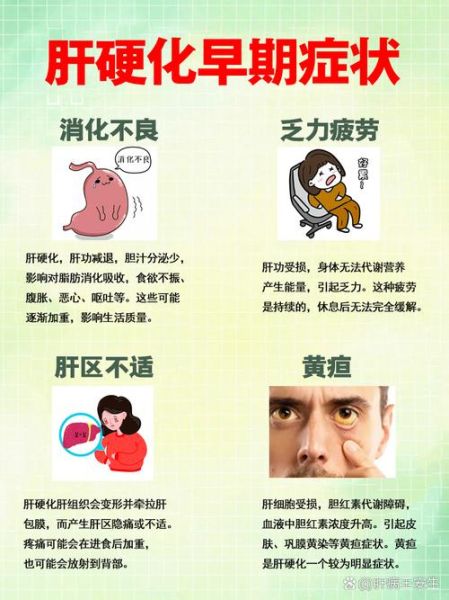 肝早期硬化需要治疗吗_肝早期硬化能自愈吗-第1张图片-山城妙识