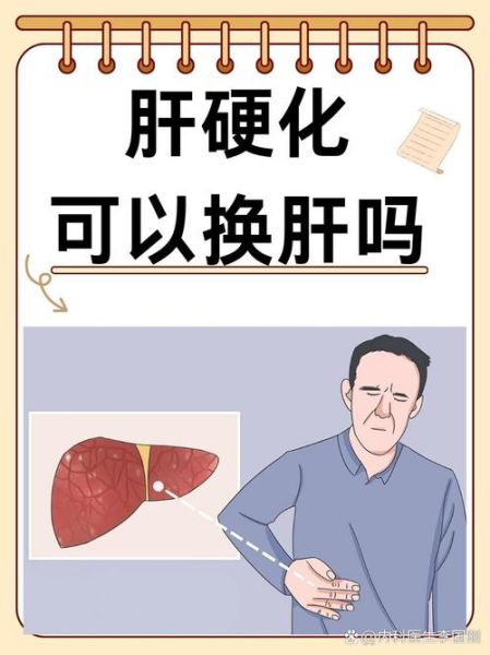 肝早期硬化需要治疗吗_肝早期硬化能自愈吗-第2张图片-山城妙识