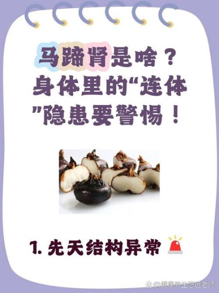 马蹄肾是怎么回事_马蹄肾严重吗-第1张图片-山城妙识 马蹄肾是怎么回事_马蹄肾严重吗-第1张图片-山城妙识