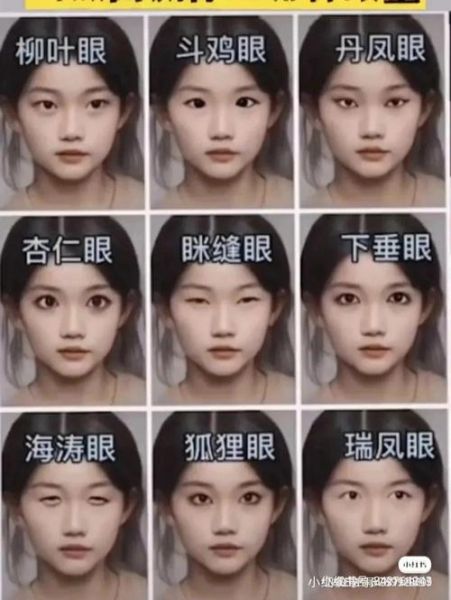 腰果眼图片_腰果眼是什么病-第1张图片-山城妙识 腰果眼图片_腰果眼是什么病-第1张图片-山城妙识