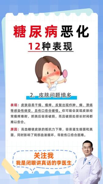 血糖高的早期症状有哪些_怎么判断是不是高血糖-第2张图片-山城妙识 血糖高的早期症状有哪些_怎么判断是不是高血糖-第2张图片-山城妙识