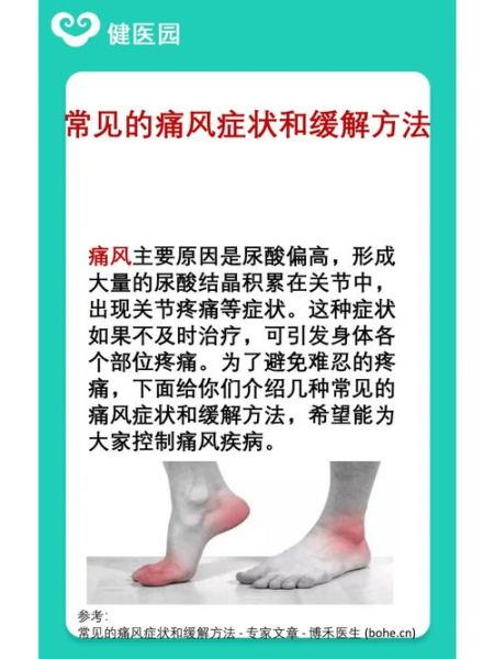 痛风发作怎么快速止痛_痛风急性期怎么办-第1张图片-山城妙识