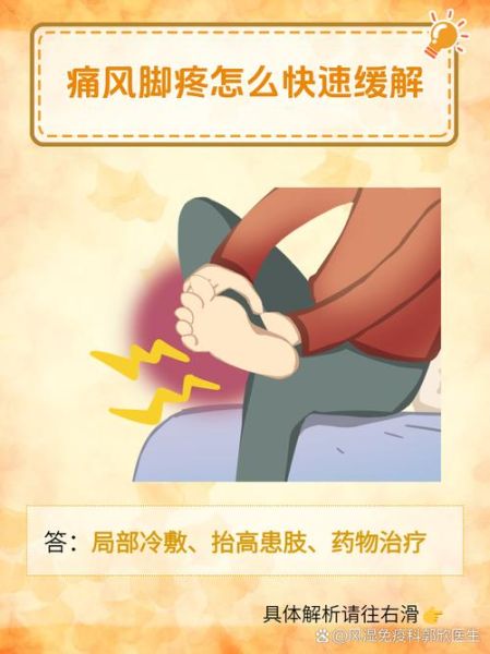 痛风发作怎么快速止痛_痛风急性期怎么办-第2张图片-山城妙识