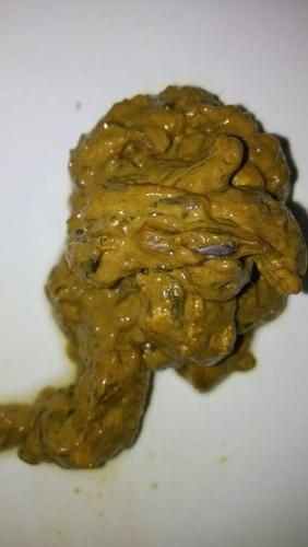 肠癌大便图片_肠癌早期大便特征-第2张图片-山城妙识 肠癌大便图片_肠癌早期大便特征-第2张图片-山城妙识