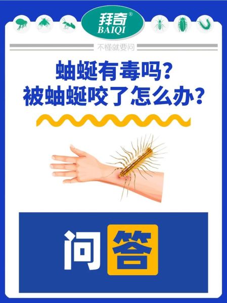 蚰蜒有毒吗_被蚰蜒咬了怎么办-第1张图片-山城妙识