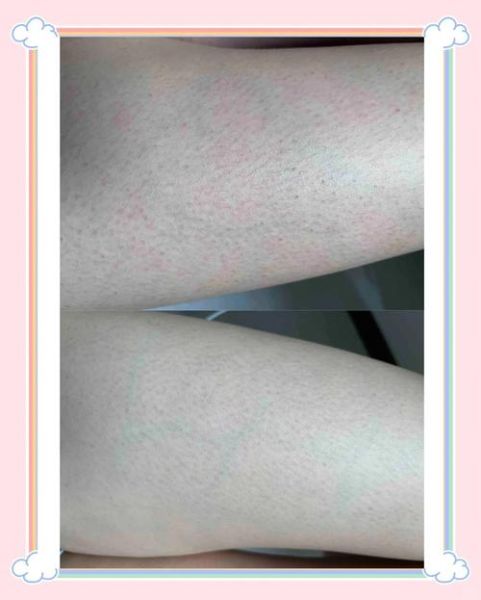 鸡皮肤长什么样子_鸡皮肤图片真实照片-第2张图片-山城妙识 鸡皮肤长什么样子_鸡皮肤图片真实照片-第2张图片-山城妙识