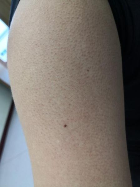 鸡皮肤长什么样子_鸡皮肤图片真实照片-第3张图片-山城妙识 鸡皮肤长什么样子_鸡皮肤图片真实照片-第3张图片-山城妙识