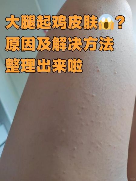 鸡皮肤长什么样子_鸡皮肤图片真实照片-第1张图片-山城妙识 鸡皮肤长什么样子_鸡皮肤图片真实照片-第1张图片-山城妙识