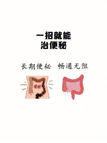 便秘怎么办_快速解决8种方法-第2张图片-山城妙识 便秘怎么办_快速解决8种方法-第2张图片-山城妙识