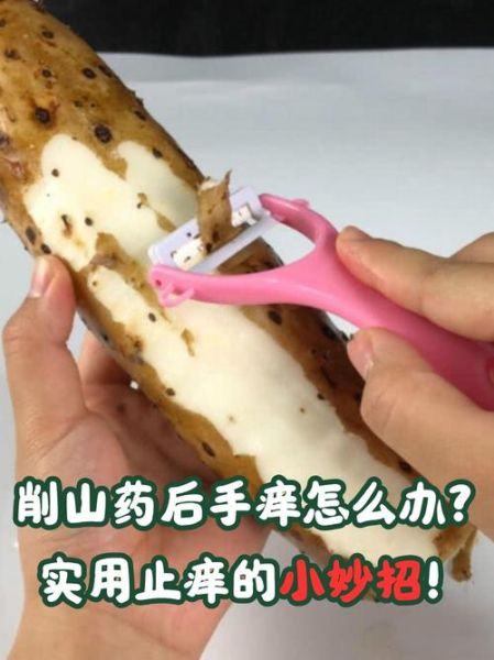 削山药皮后手痒怎么办_止痒小妙招-第1张图片-山城妙识