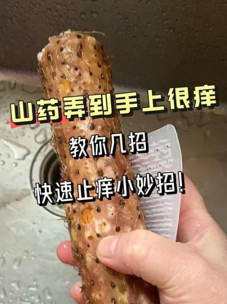 削山药皮后手痒怎么办_止痒小妙招-第2张图片-山城妙识