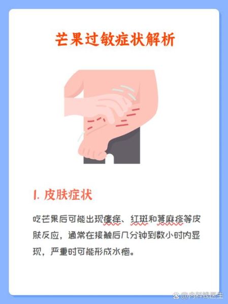 芒果过敏症状有哪些_哪些人不适合吃芒果-第1张图片-山城妙识