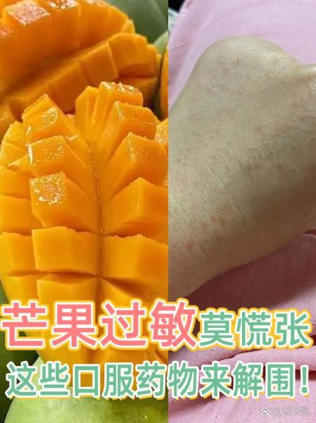 芒果过敏症状有哪些_哪些人不适合吃芒果-第2张图片-山城妙识