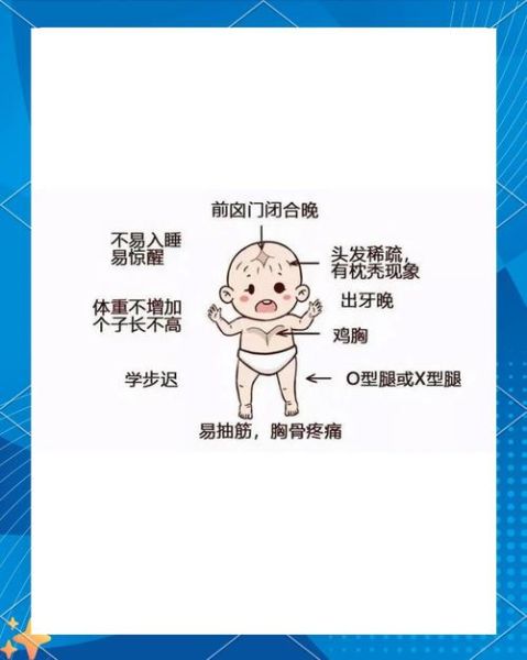佝偻病早期症状图片_佝偻病能治好吗-第3张图片-山城妙识 佝偻病早期症状图片_佝偻病能治好吗-第3张图片-山城妙识