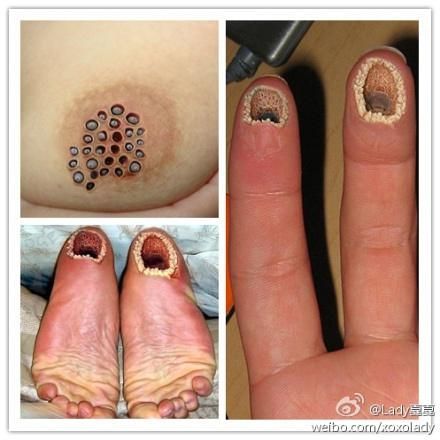 密集恐惧症图片测试图_怎么判断自己有没有密集恐惧症-第1张图片-山城妙识 密集恐惧症图片测试图_怎么判断自己有没有密集恐惧症-第1张图片-山城妙识