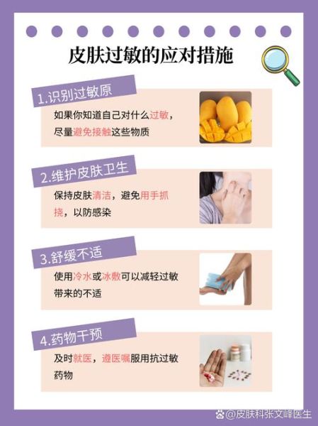 皮肤过敏了怎么办最快方法_皮肤过敏止痒小妙招-第3张图片-山城妙识 皮肤过敏了怎么办最快方法_皮肤过敏止痒小妙招-第3张图片-山城妙识