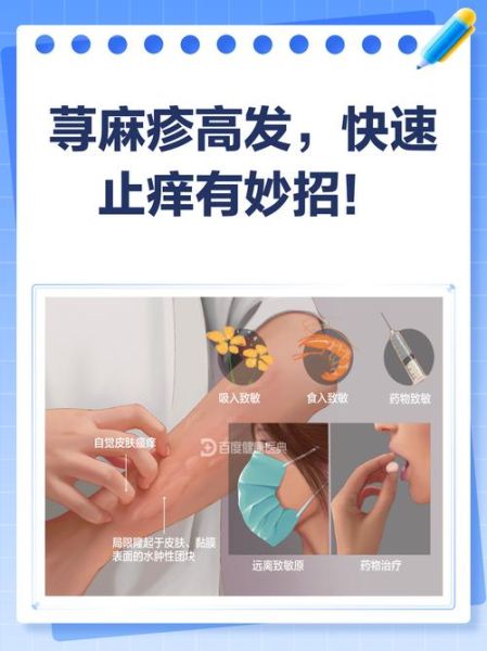 皮肤过敏了怎么办最快方法_皮肤过敏止痒小妙招-第2张图片-山城妙识 皮肤过敏了怎么办最快方法_皮肤过敏止痒小妙招-第2张图片-山城妙识