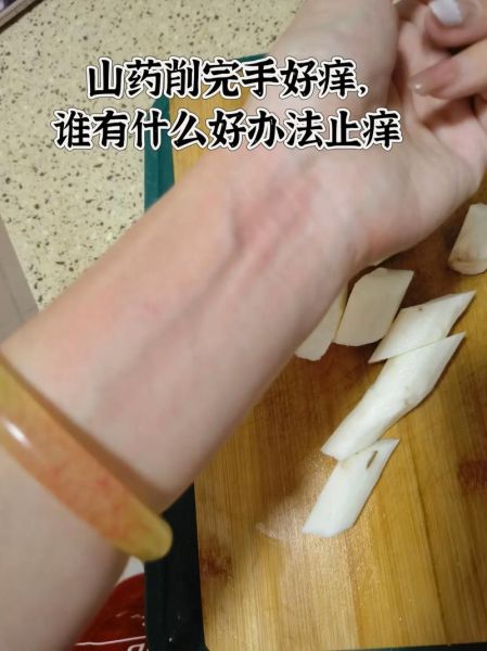 山药手痒怎么办_最快止痒方法-第2张图片-山城妙识