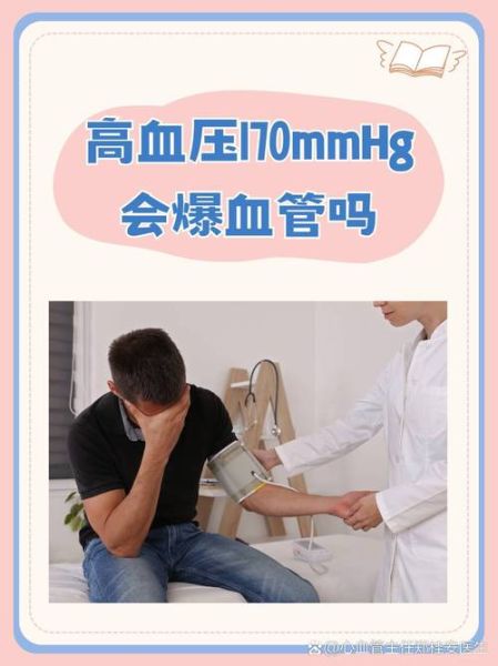 血压170严重吗_高血压170怎么办-第1张图片-山城妙识 血压170严重吗_高血压170怎么办-第1张图片-山城妙识